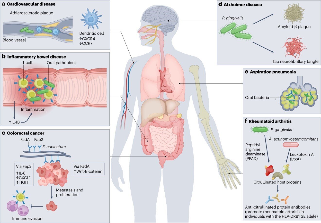 The Use of Saliva for Oral Microbiome Testing and Genetic Diagnostics ...